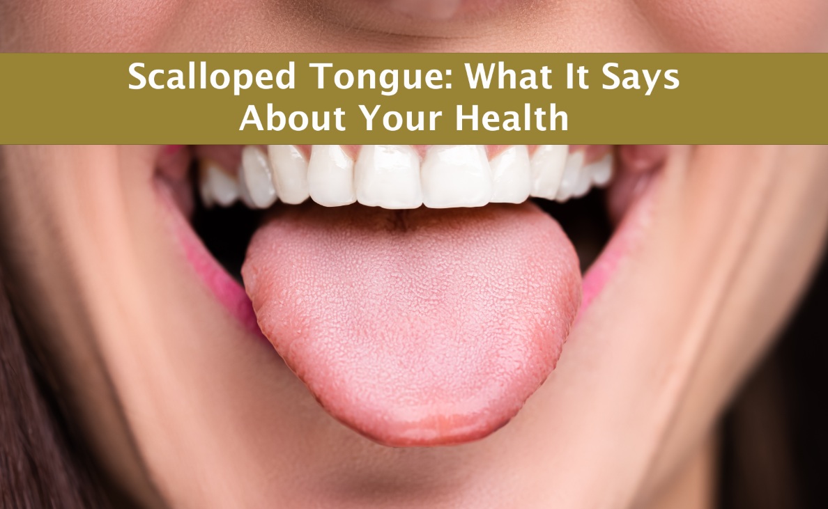 Scalloped Tongue: What It Says About Your Health
